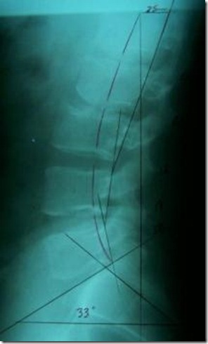 Postural Mirror-Image® Core Strengthening - American Journal of ...